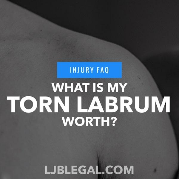 What is My Torn Labrum Shoulder Injury Worth? | Call 24/7