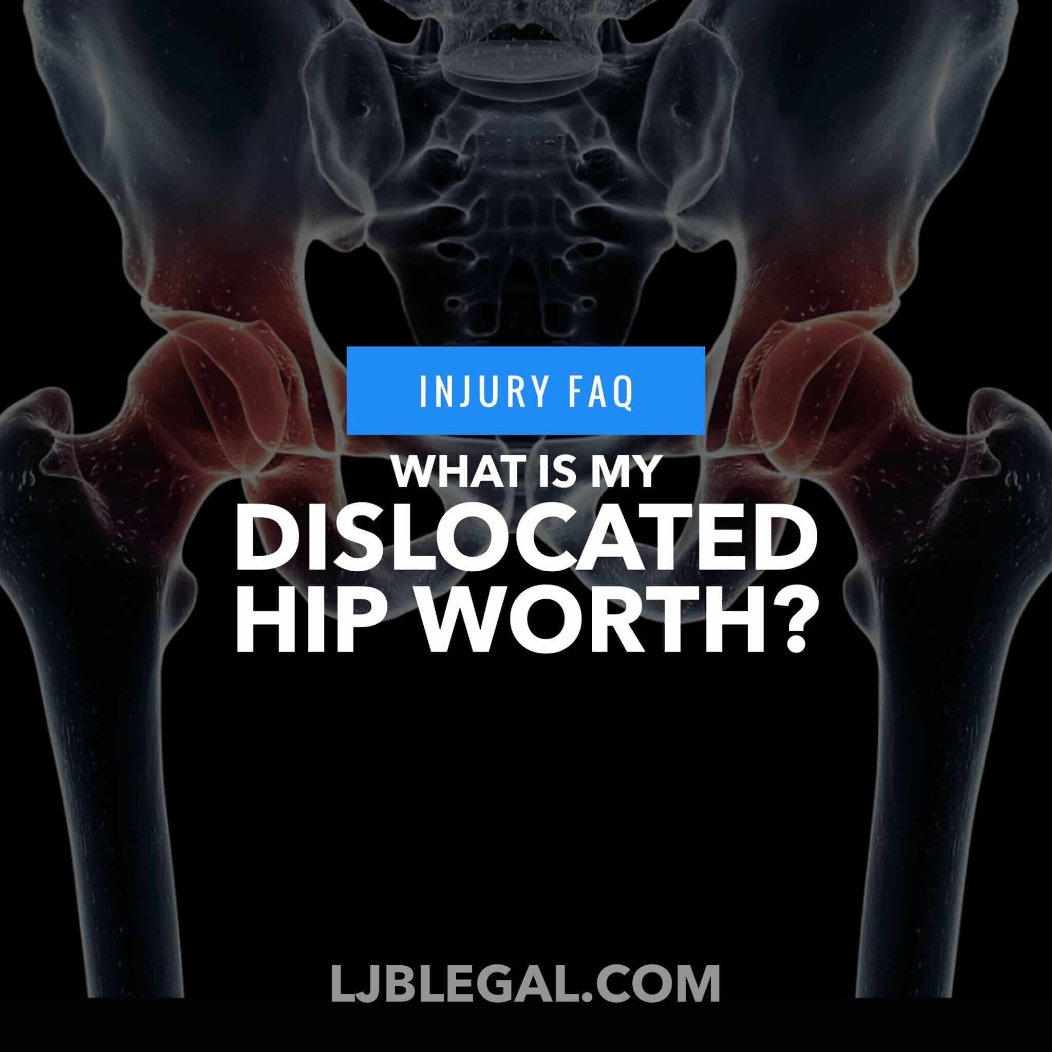 How Much is my Dislocated Hip Claim Worth After a Car Accident in ...